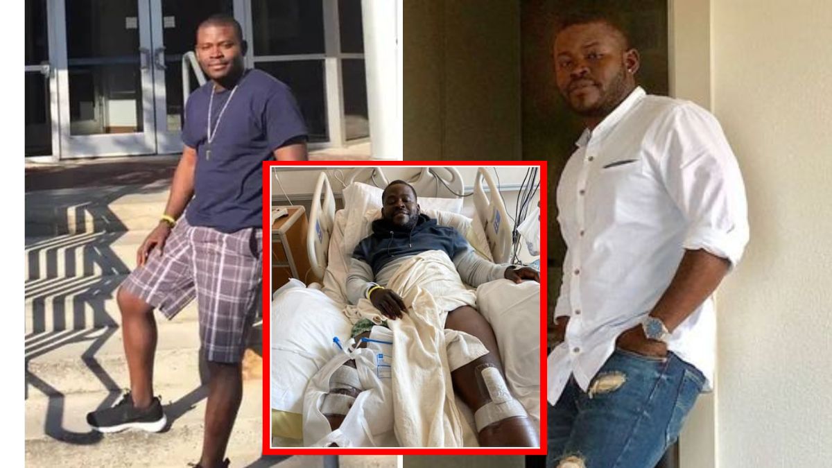 Lengthening Surgery: అమ్మాయిలు డేటింగ్‌కు రావట్లేదని కోట్లు ఖర్చు ...