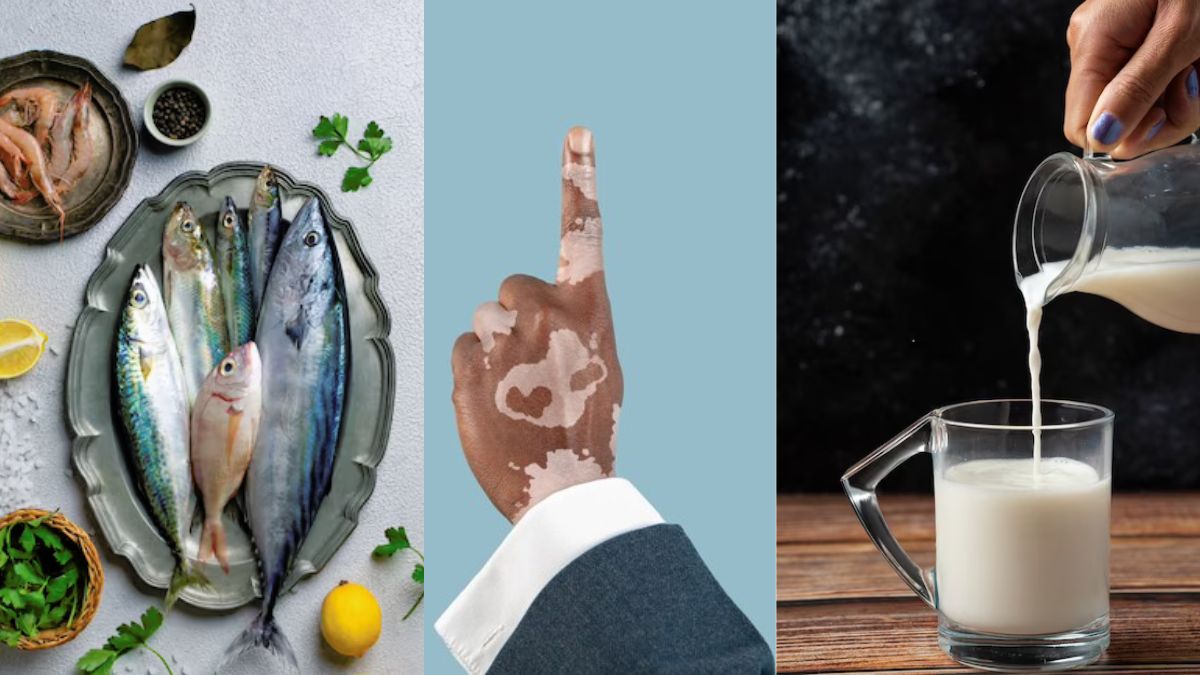 చేపలు తిన్న తర్వాత పాలు తాగితే చర్మ వ్యాధులు వస్తాయా? | Drinking Milk ...